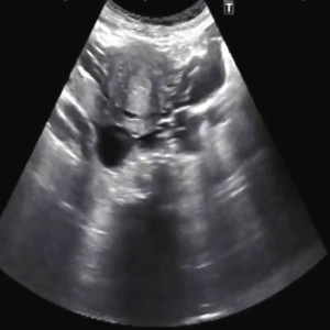 pcos multi lable classification Classification Model by wk2