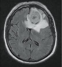 MRI Object Detection Dataset and Pre-Trained Model by research