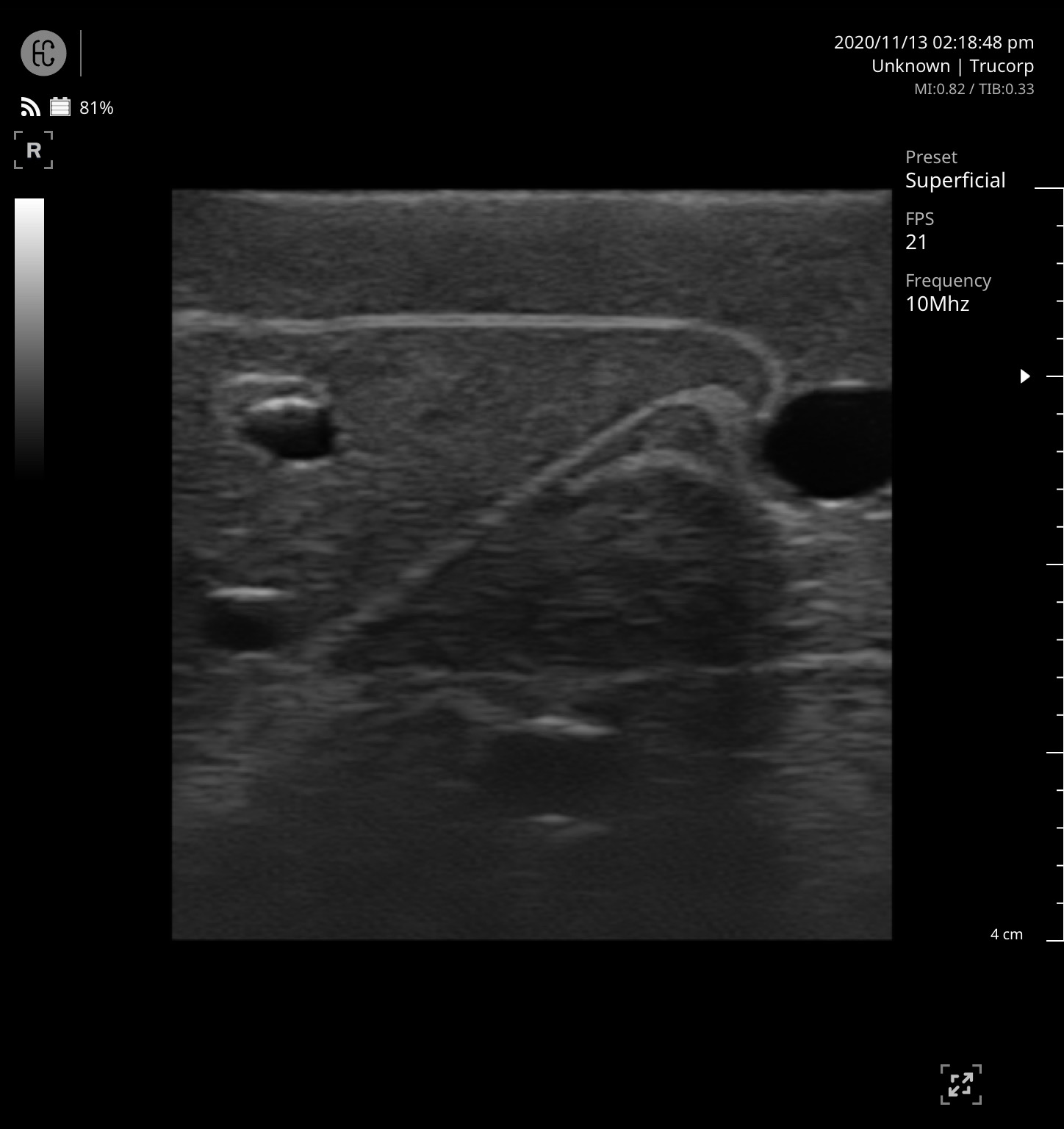 IV Block Instance Segmentation Dataset by test