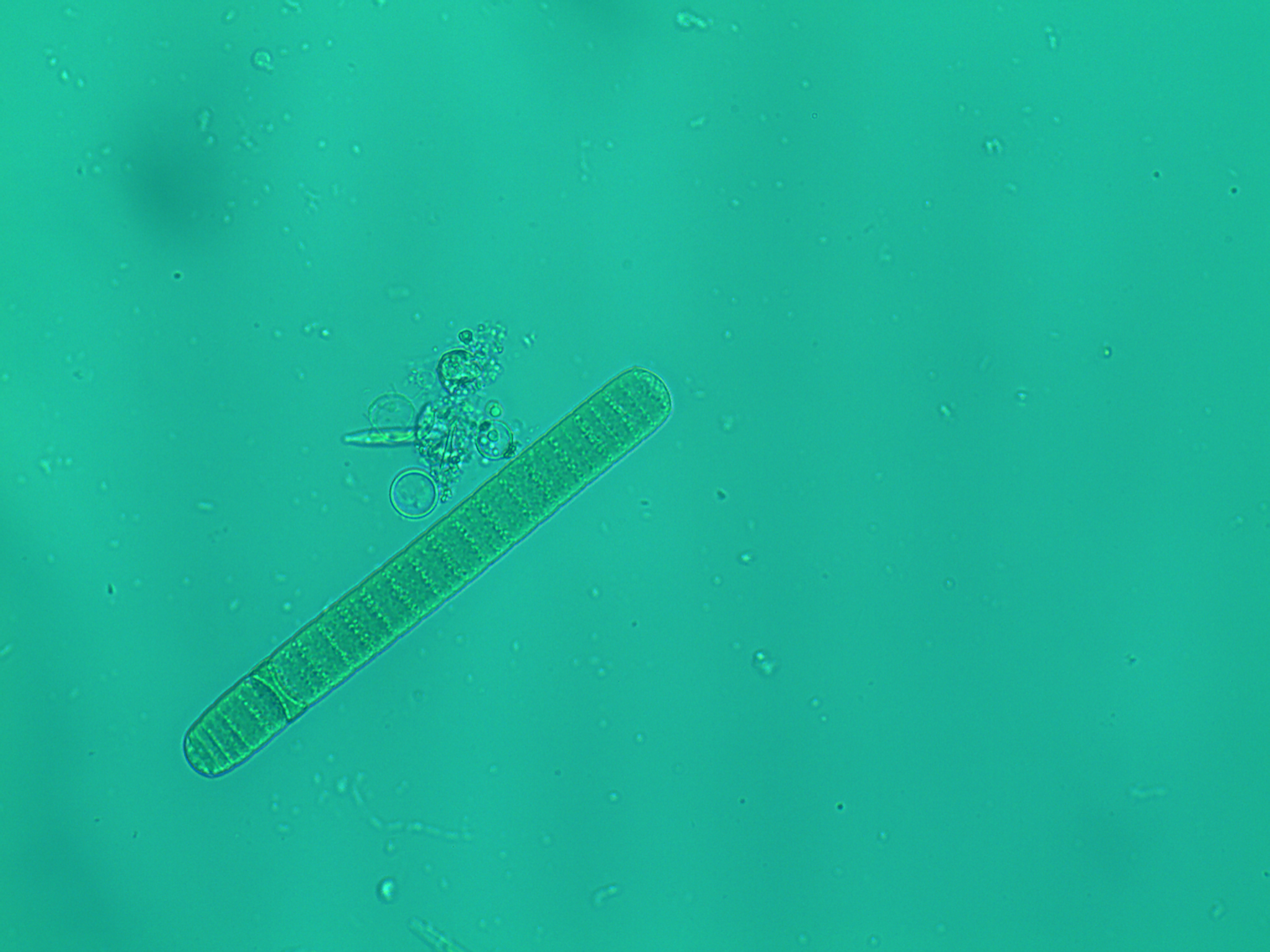 bacterial Object Detection Dataset by water bacterial detection