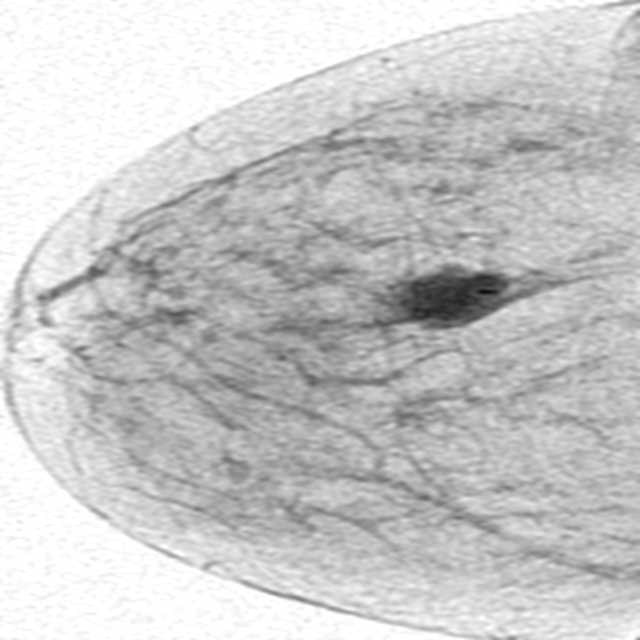 Bgc Dct Object Detection Model By Gazi Ai