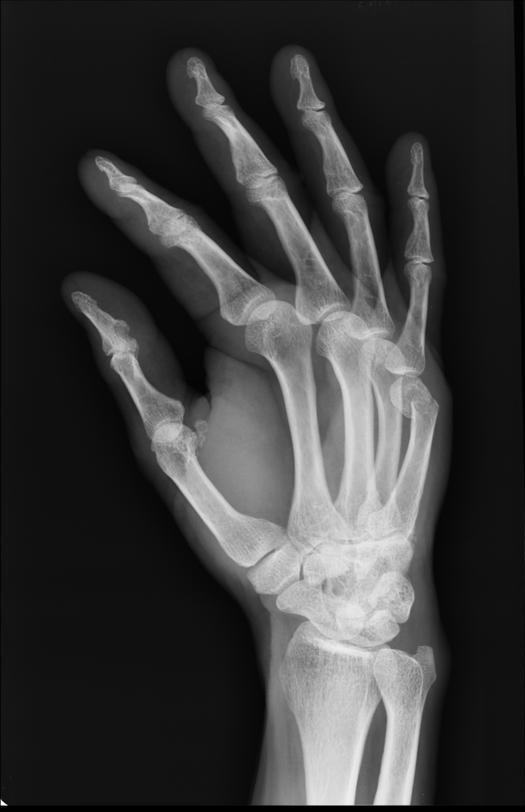 dsa-segmentation Instance Segmentation Dataset by classification