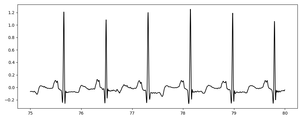 ECG-mai bun Object Detection Dataset by ECG