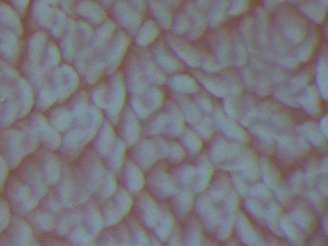 CCHMC - Roboflow Universe