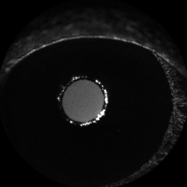 Iris Detection Instance Segmentation Dataset By Farzan