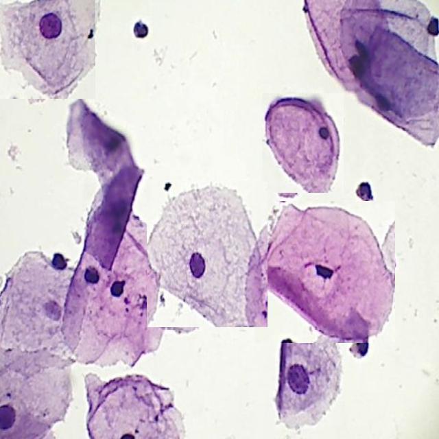 Cervical cancer Object Detection Dataset and Pre-Trained Model by Thuut