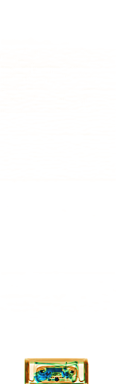 Batterydetection Object Detection Dataset By Objectdetectionusingyolo