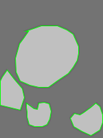 Proyecto virosis - Roboflow Universe