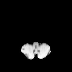 How to Use the IPA Test Object Detection API