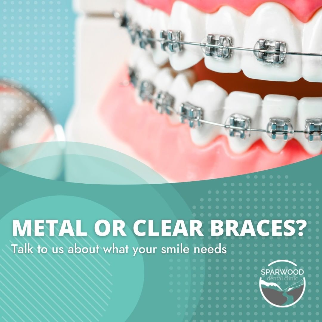 smile Object Detection Dataset by Dental Module