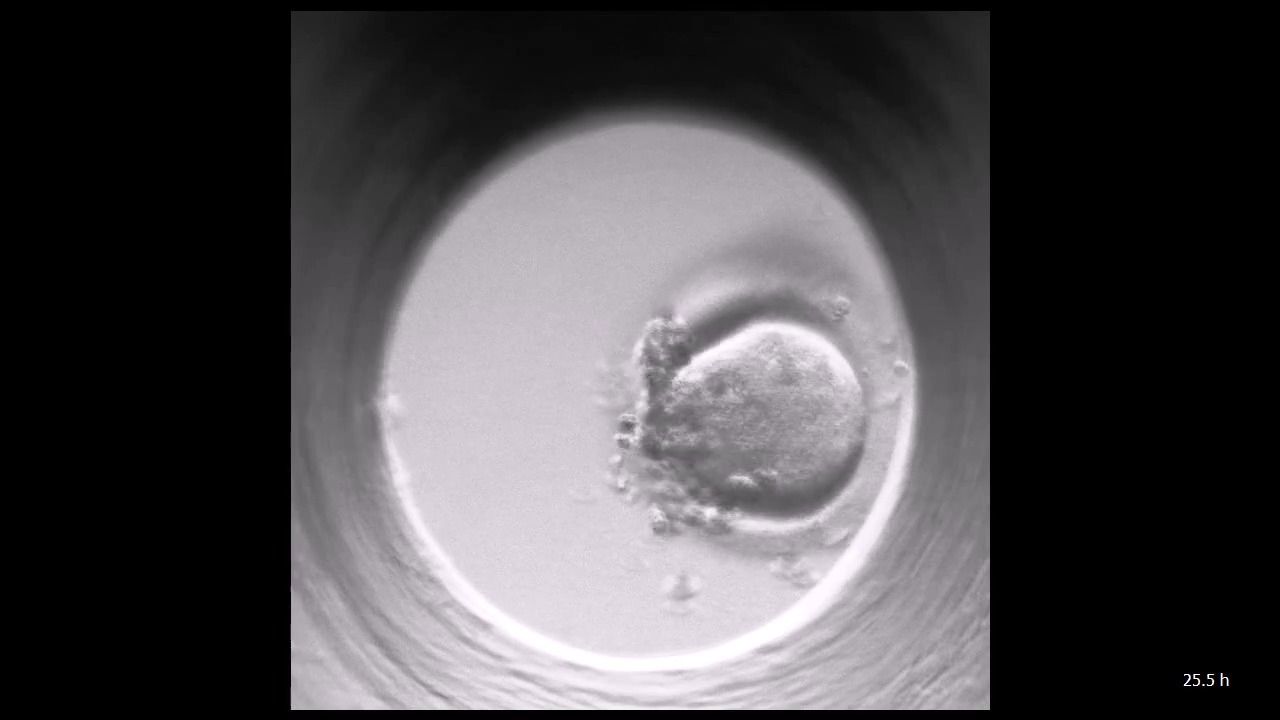 embryo-project-bounding-2025 Object Detection Dataset and Pre-Trained ...