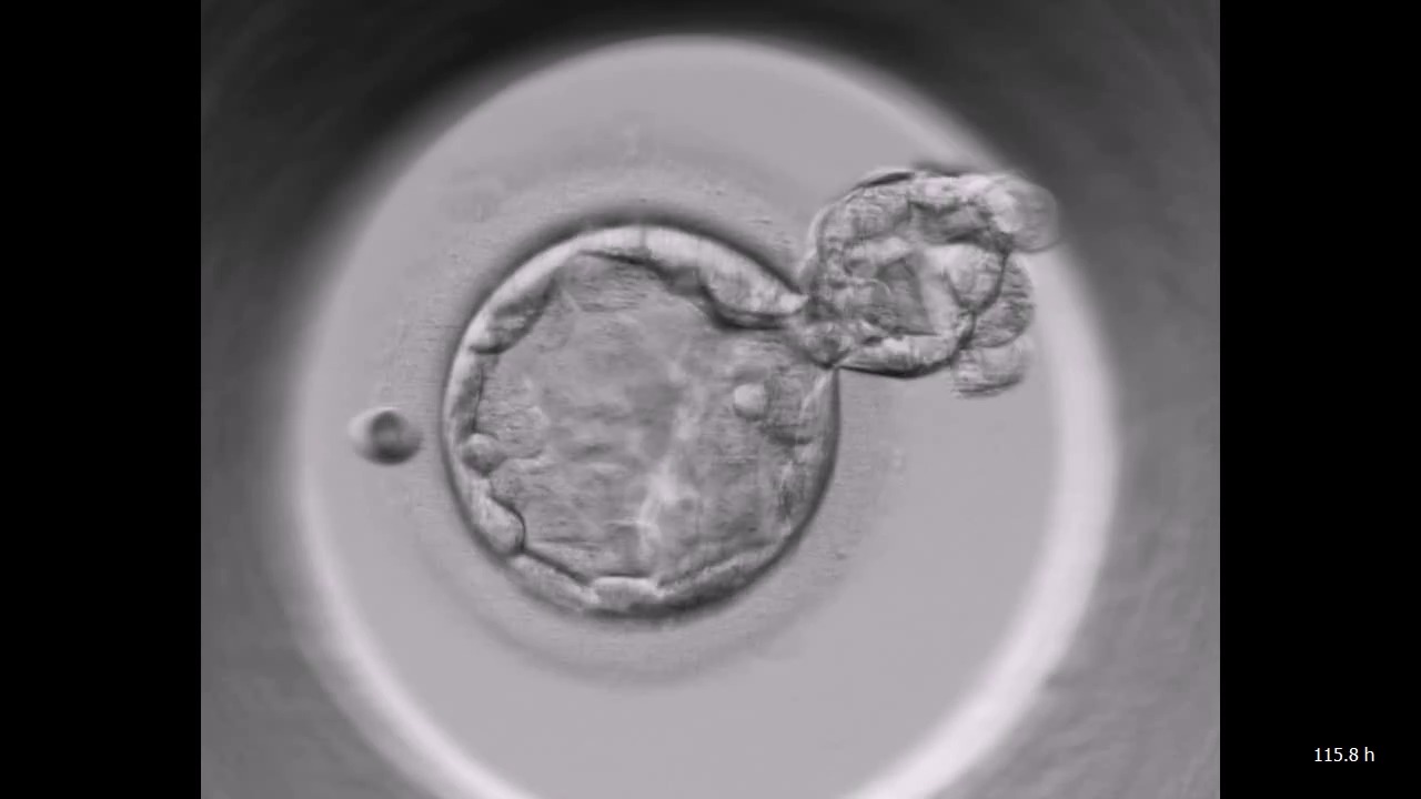 embryo-seg Instance Segmentation Dataset and Pre-Trained Model by workspace