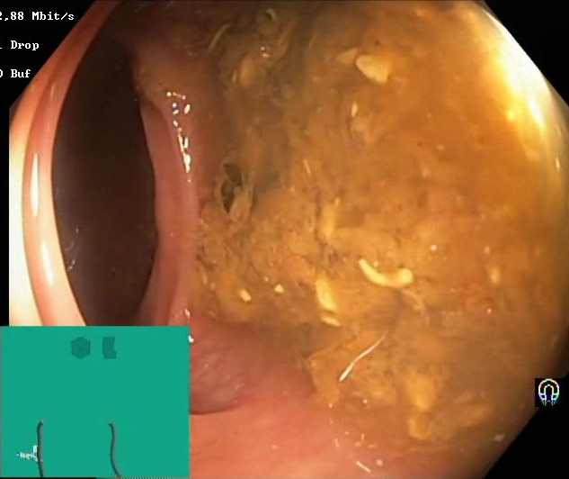 Color Guide Object Detection Dataset and Pre-Trained Model by BioScope