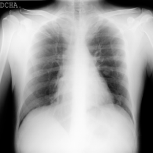 xray-classification Classification Dataset by doruk-gunveren