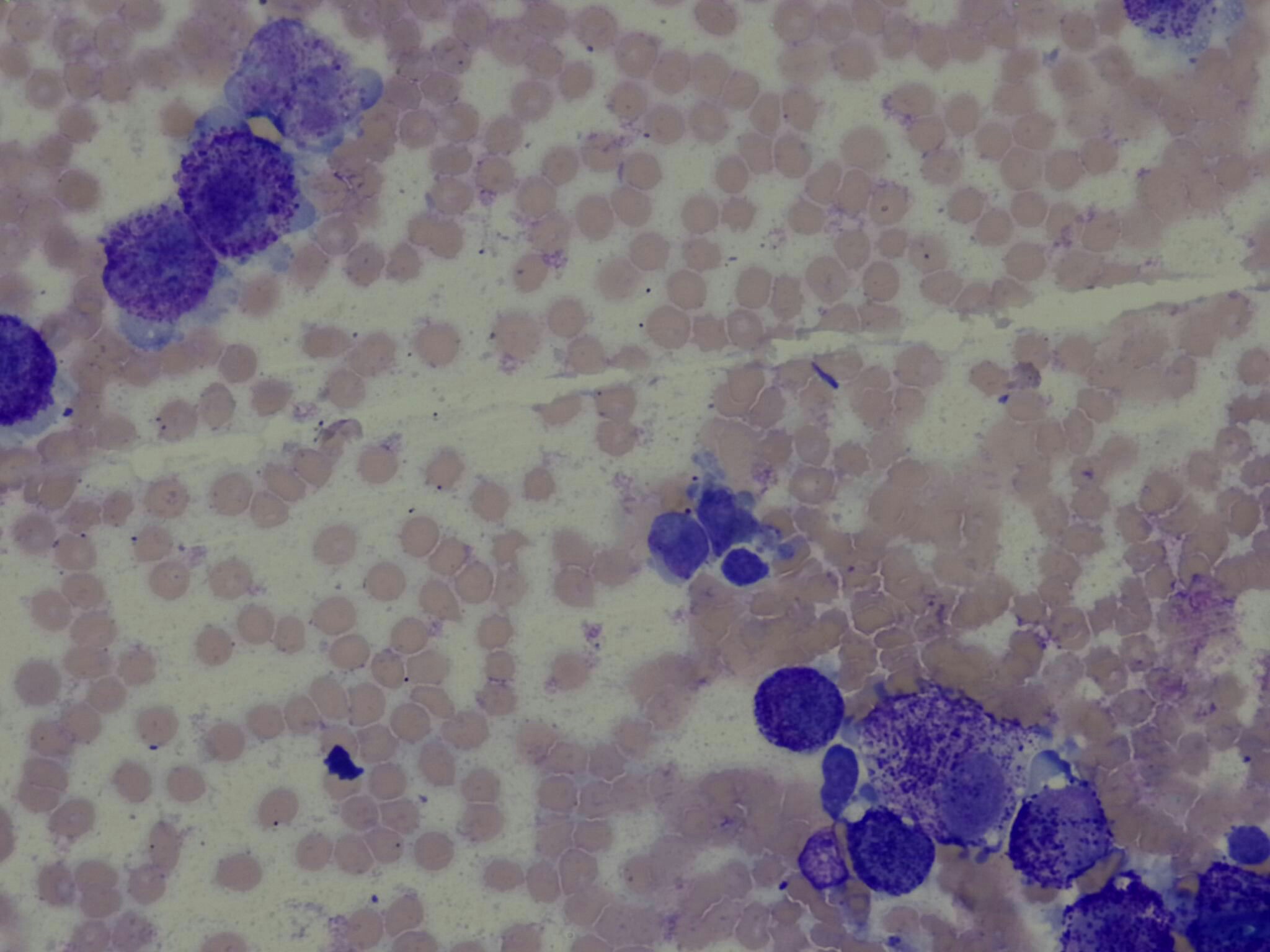 cell segmentation2 Instance Segmentation Dataset by project