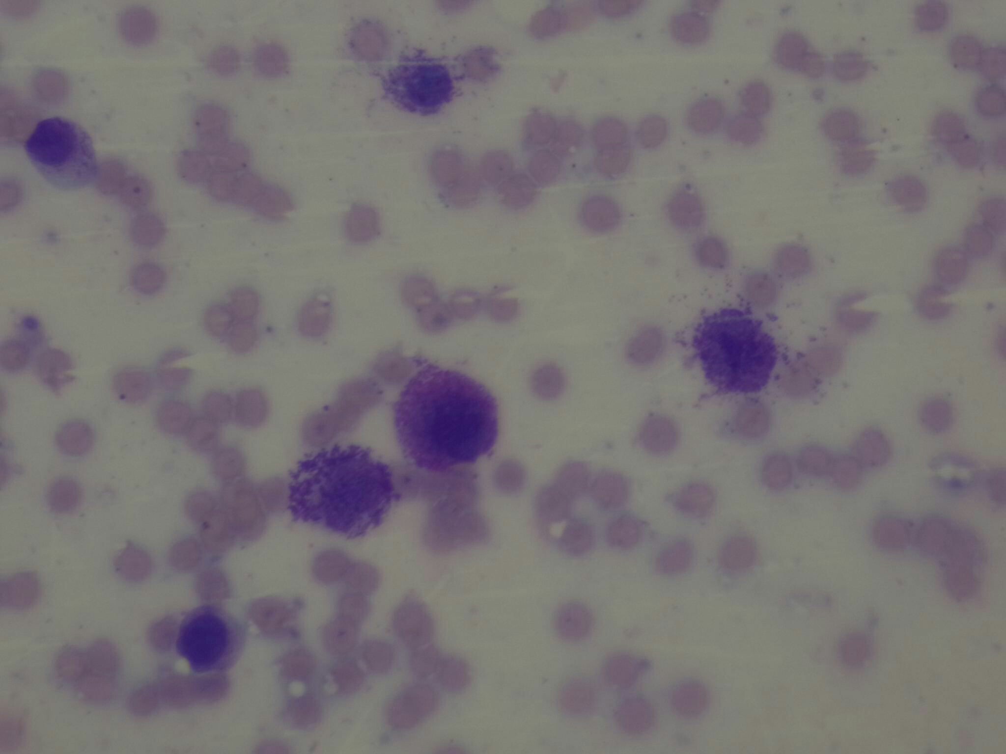 cell segmentation2 Instance Segmentation Dataset by project