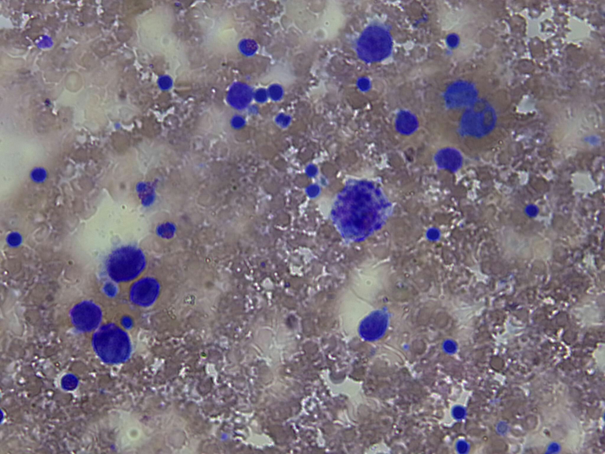 Cell Detection2 Object Detection Dataset And Pre Trained Model By Project