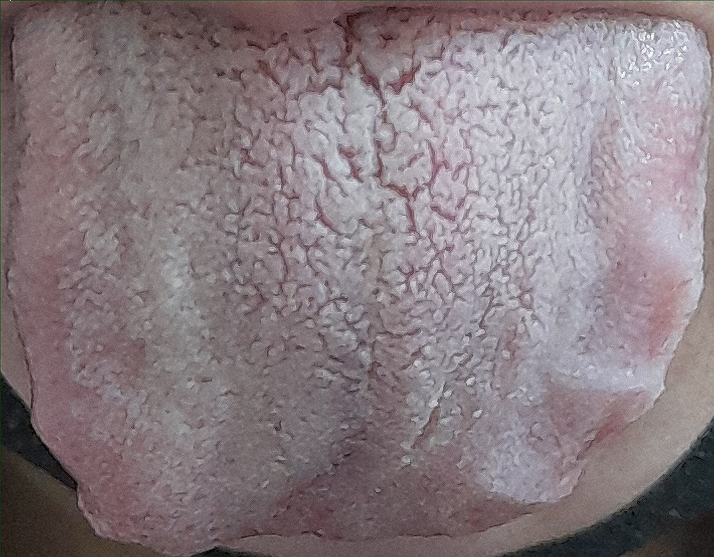 Custom Workflow Instance Segmentation Instance Segmentation Dataset By