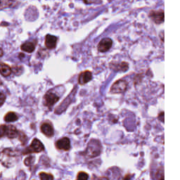 lmpdet Instance Segmentation Dataset by bitirme