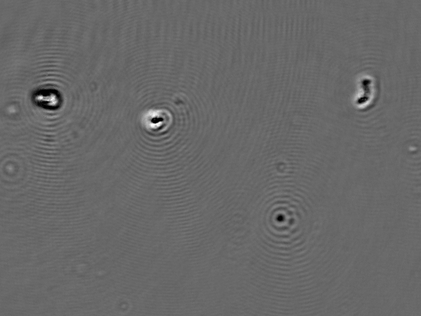 Bacteria Lager Set2 Object Detection Dataset By Abha Gejji