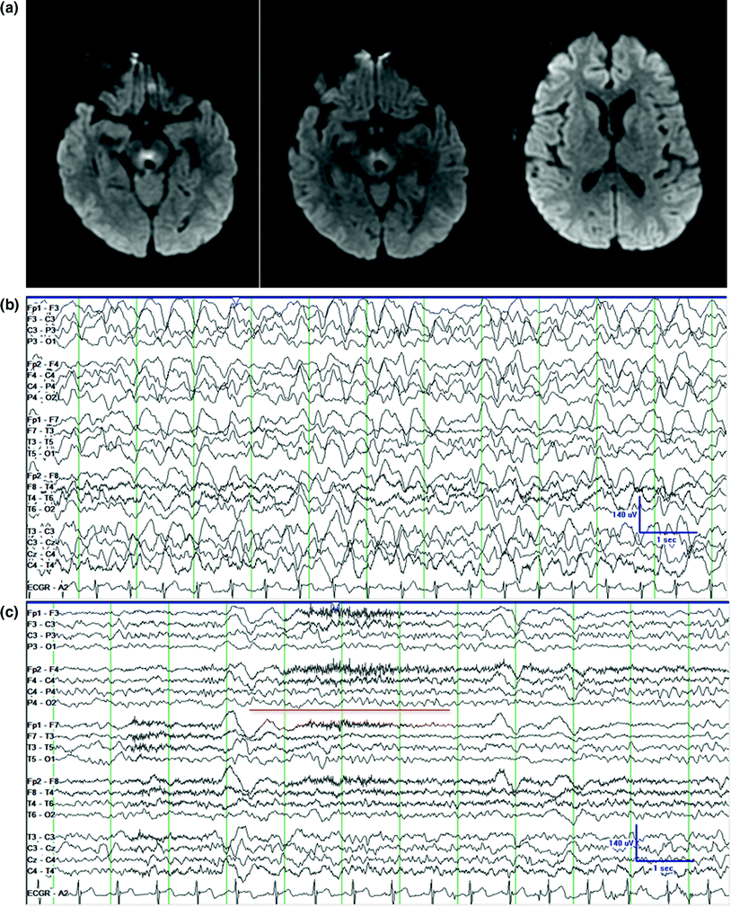 EEG Object Detection Dataset by Roaa