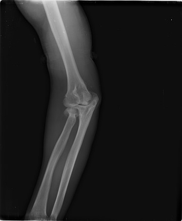 ibi2 Object Detection Dataset by ibraimatay