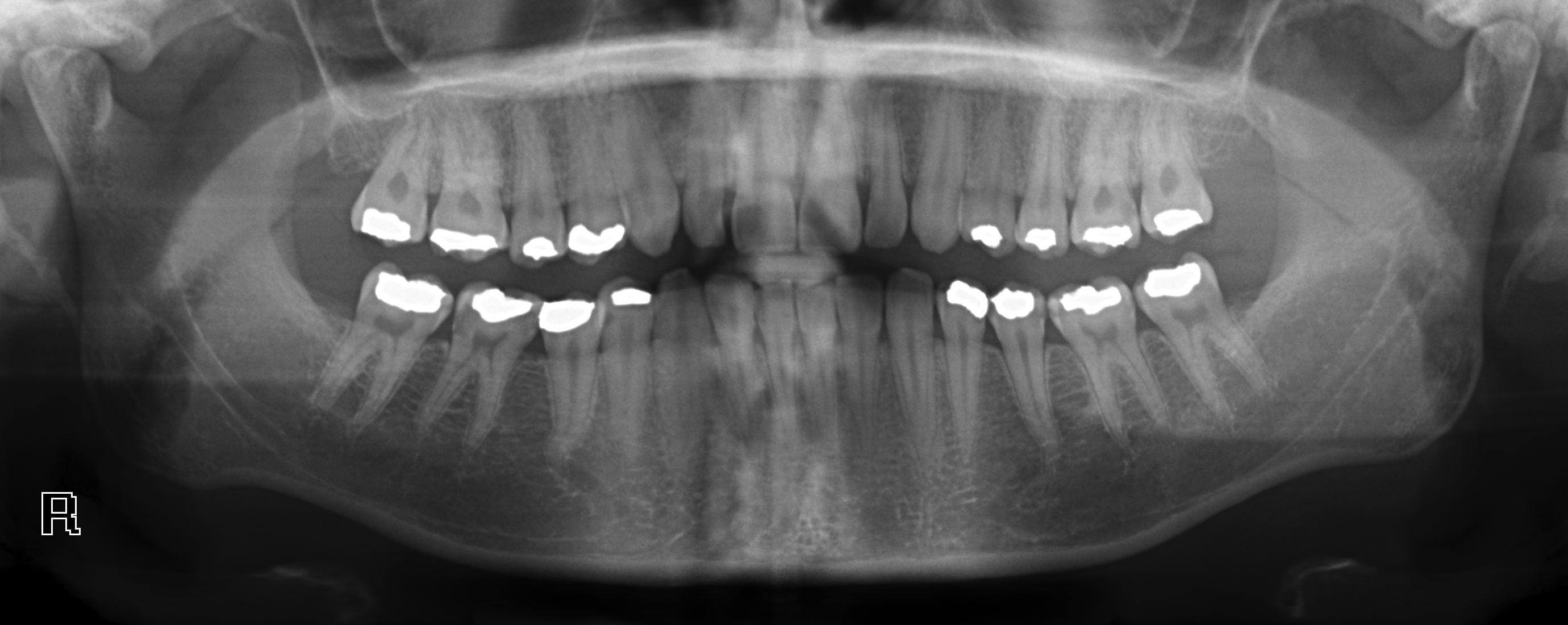 Will A. (will-a-) - Roboflow Universe