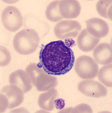 lymphocyte test Object Detection Dataset and Pre-Trained Model by MOBIV