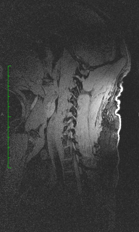 Basil Instance Segmentation Dataset by Neural Engineering