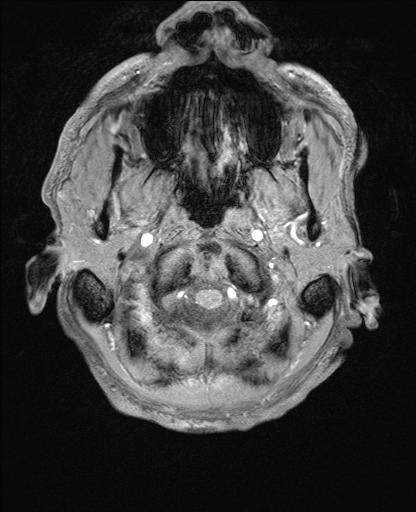 subject 11 Instance Segmentation Dataset by Neural Engineering