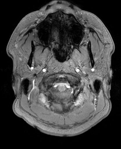 mri scans Instance Segmentation Dataset by Neural Engineering