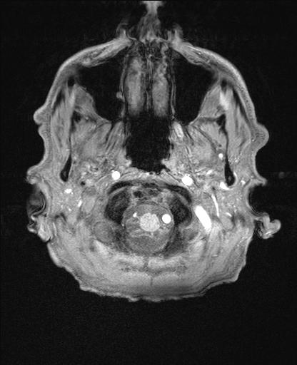 subject 10 Instance Segmentation Dataset by Neural Engineering