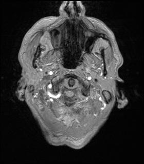 subject 7 Instance Segmentation Dataset by Neural Engineering