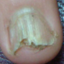 Nail Detection Object Detection Dataset by seandev