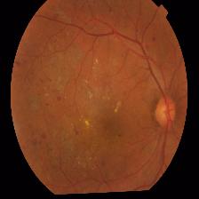 My First Project Classification Dataset by AMDDetection