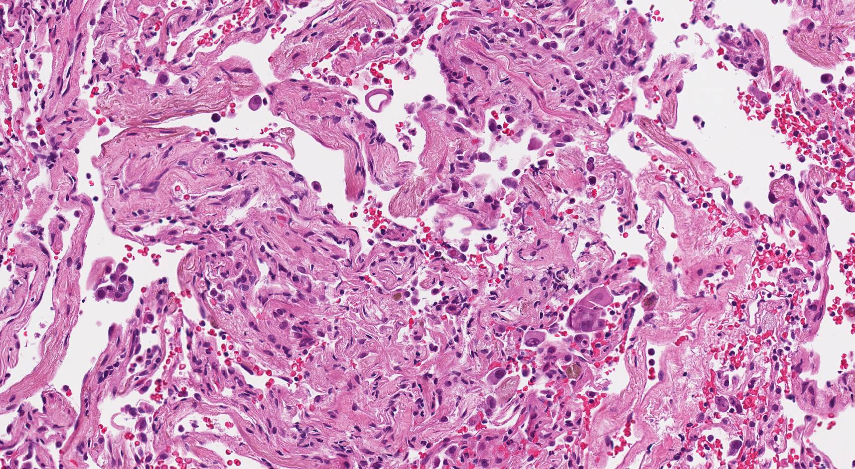 obj_detect Object Detection Dataset by tbrain