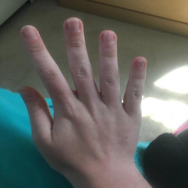 Measure Liquid Density Object Detection Model V1 2024 09 14 6 37am By Yolov8detectelec