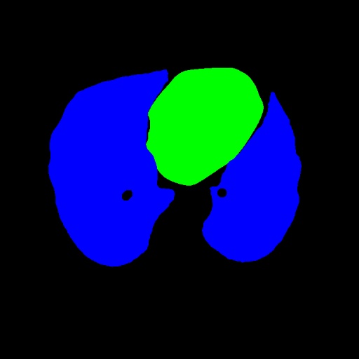 lungs Instance Segmentation Dataset by XCT