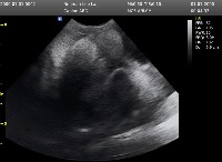NRT Sonogram Project - Roboflow Universe