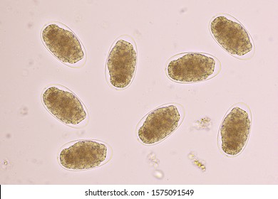 Parasite Detection Object Detection Dataset by Mo Fotouhi