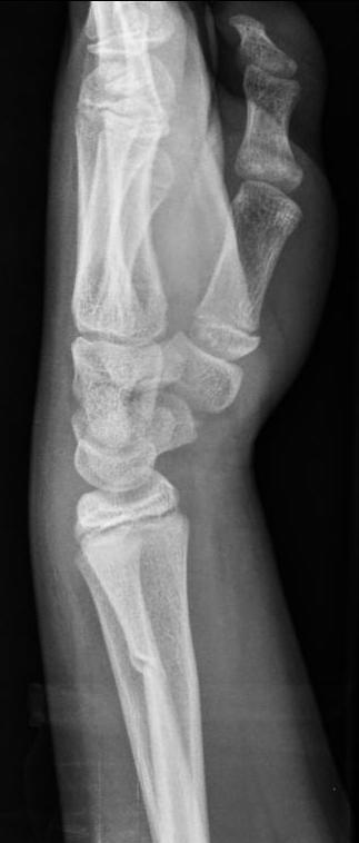 Wrist Model Classification Dataset By Faculty Of Computer And Information Science