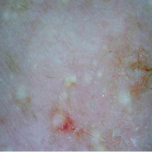 dry_augmentation Object Detection Dataset by XDE