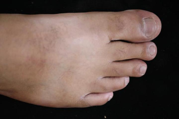 feet_classification Classification Dataset by semihocakli