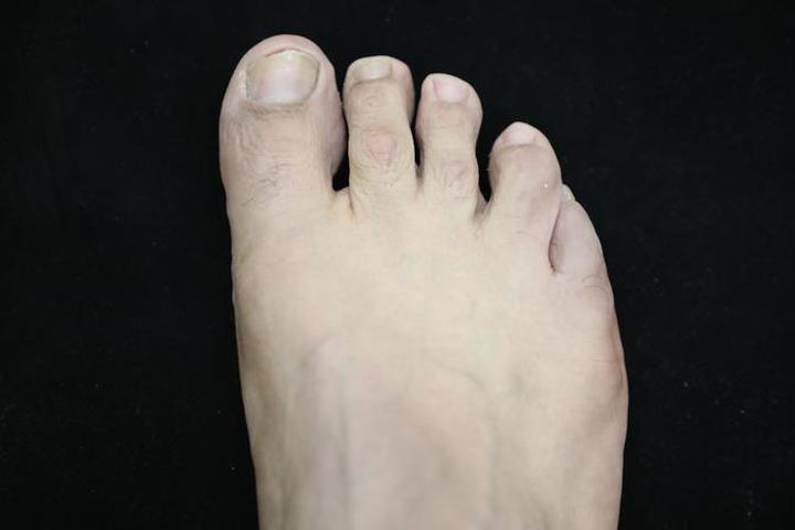 feet detection Object Detection Dataset by semihocakli