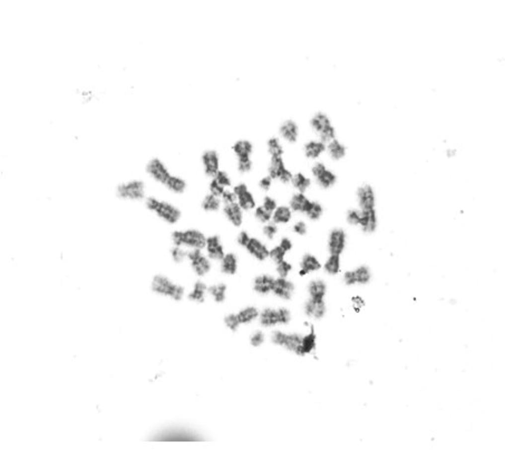 Chromosomes Instance Segmentation Dataset and Pre-Trained Model by Lazareva Veronika