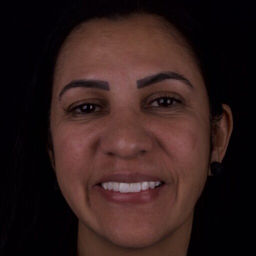 Smile teeth Object Detection Dataset by Avila