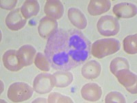 Nihars Workspace - Roboflow Universe