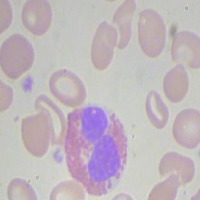 Nihars Workspace - Roboflow Universe