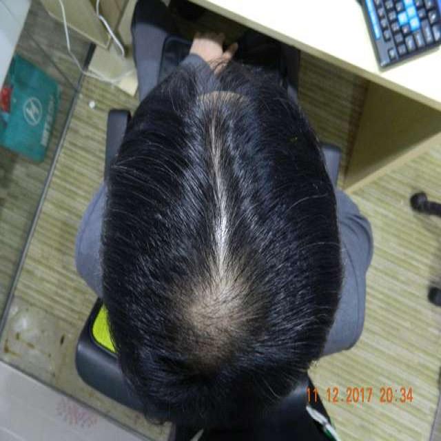 hay5 Instance Segmentation Dataset by try