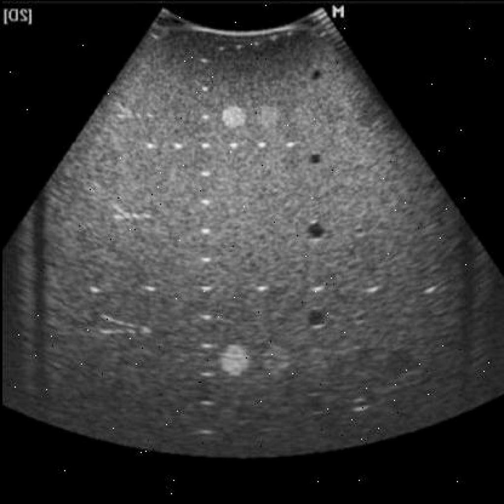 For Pins Object Detection Dataset And Pre Trained Model By Sy